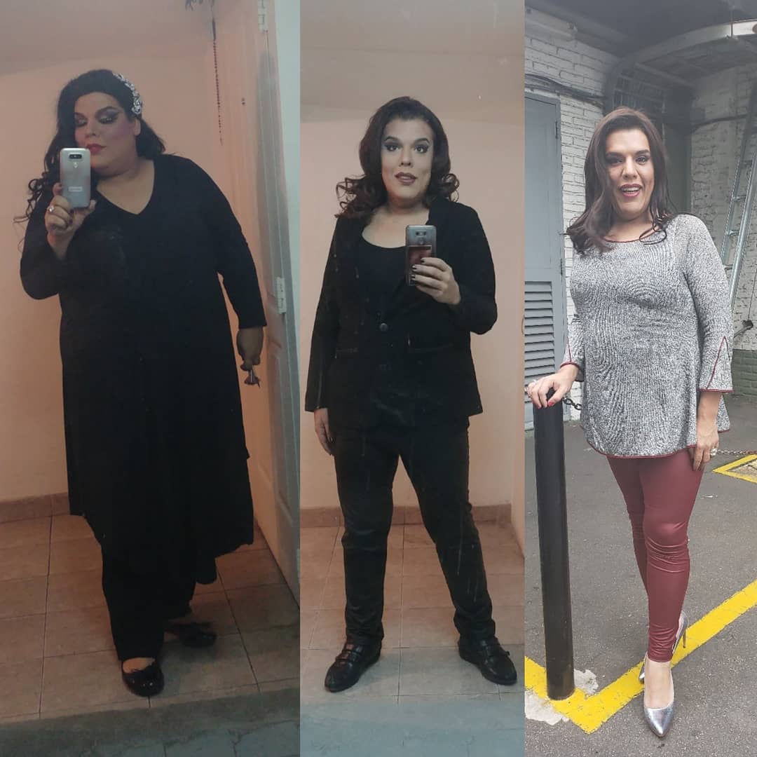 Gonzalo Costa: «Me operé y me saqué toda la grasa que tenía» – GENTE Online