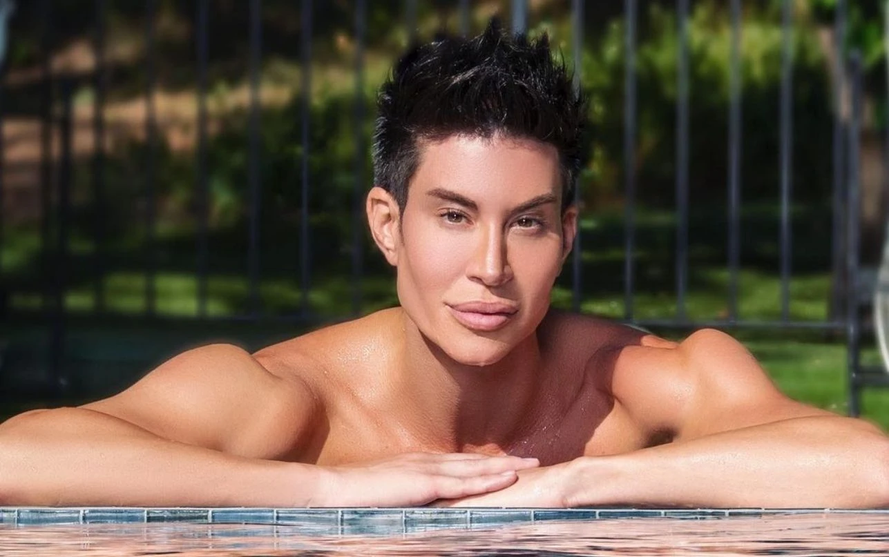 Quién es Justin Jedlica, el ‘Ken humano’, que se hizo mil cirugías para ...