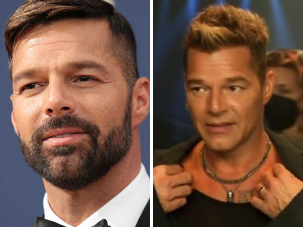 Ricky Martin: cómo es el suero vitaminado que le inflamó el rostro y ...