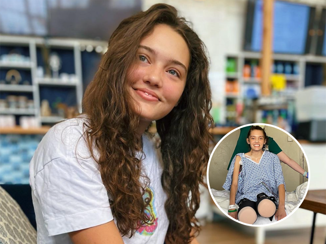 ¡Dramático! Claire Bridges, la modelo de 21 años, tuvo una complicación ...