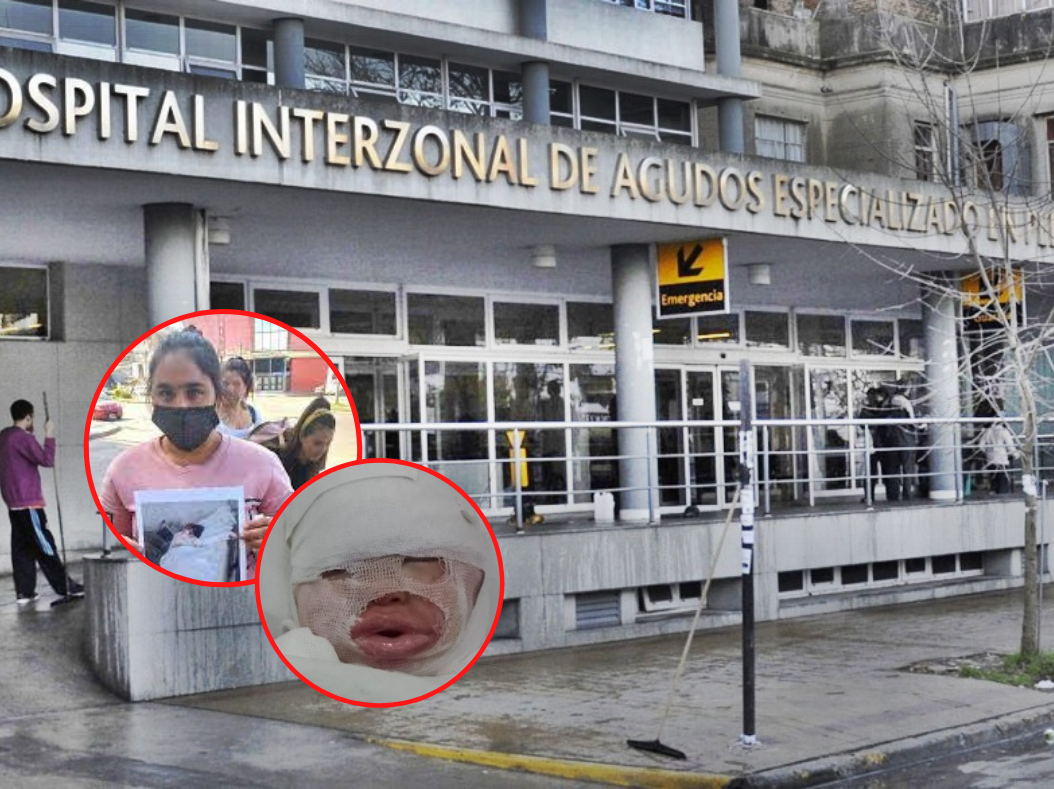 ¡Preocupante! Habló la madre de la nena de 3 años a la que le volcaron ...