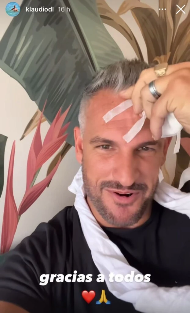 Apareció "Papucho" de Gran Hermano tras ser operado de urgencia y preocupó a sus seguidores ...