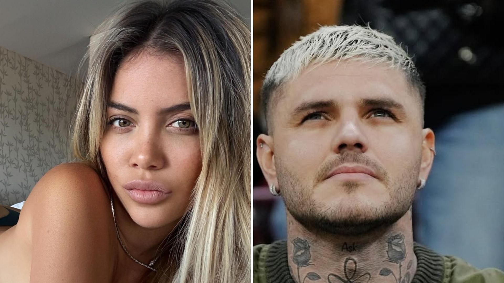 De qué se operó Wanda Nara en medio del conflicto con Mauro Icardi y por qué hay dos versiones ...