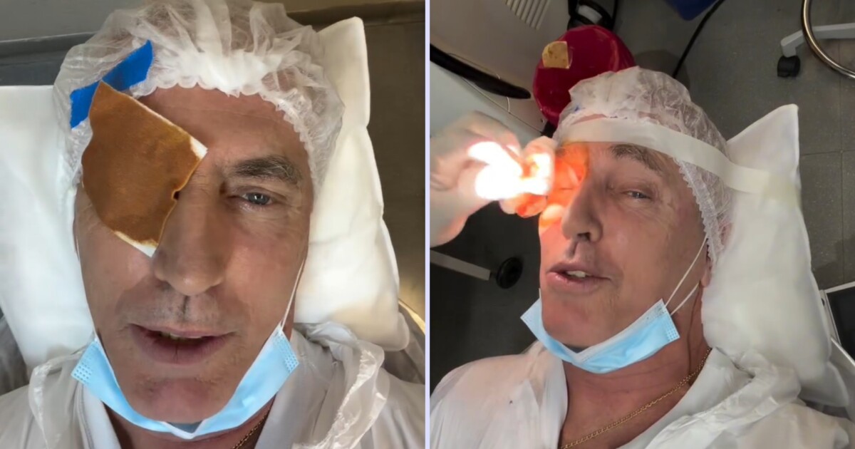 “Parezco un pirata”: Marley fue operado de nuevo y mostró cómo avanza ...